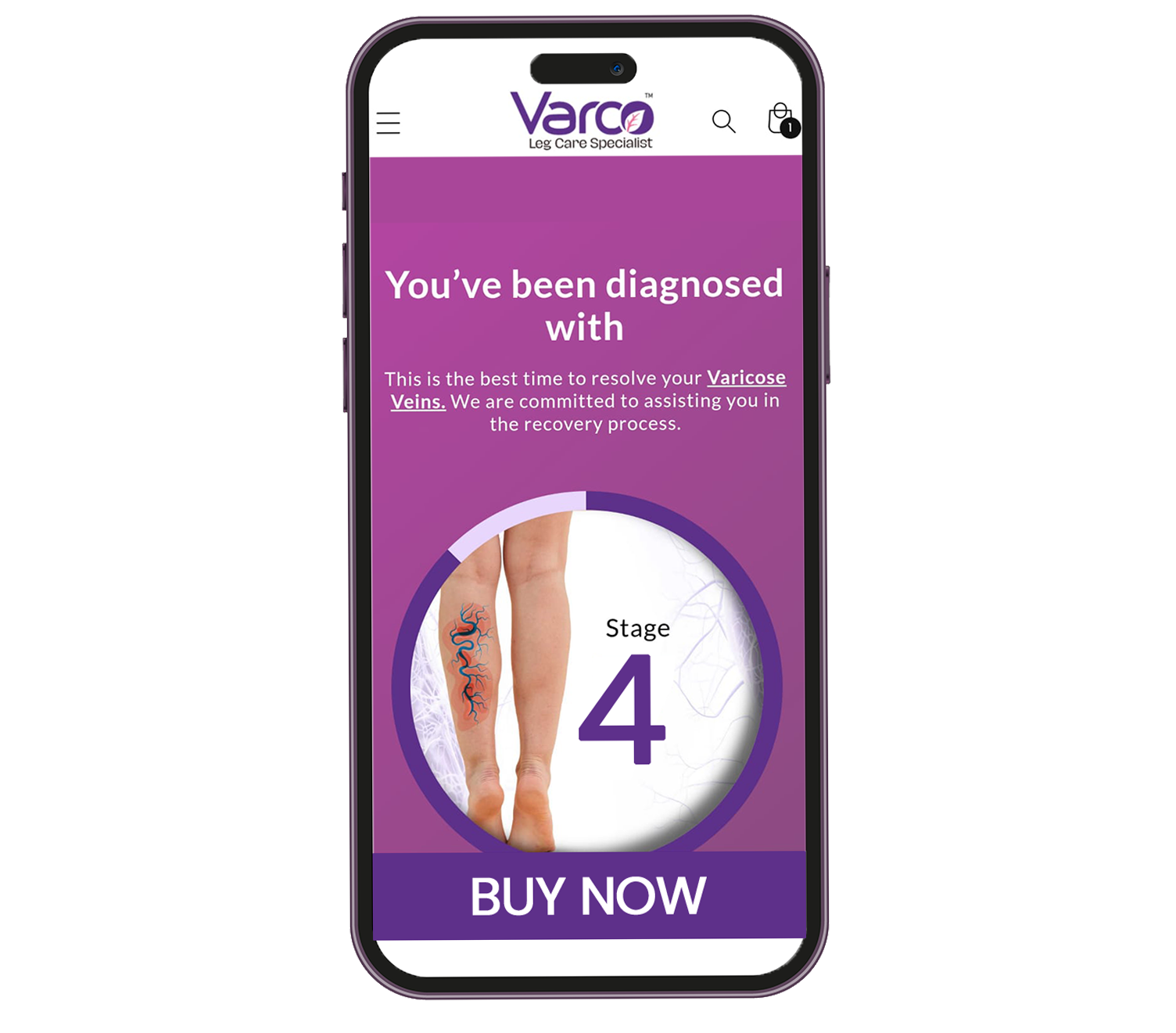 Varco Leg Care
