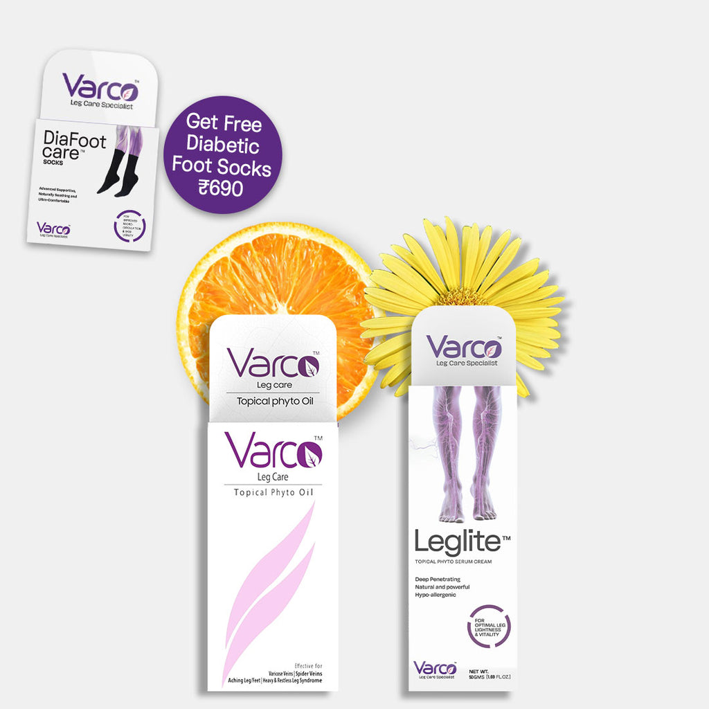 Varicose Veins – Varco Leg Care
